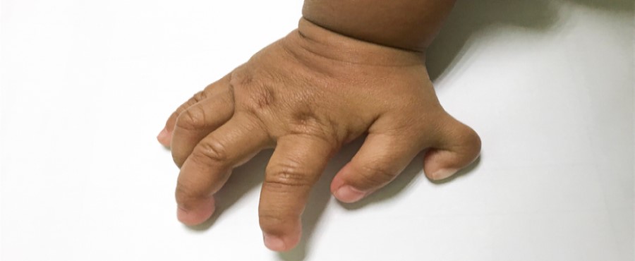 ¿Qué es una Mutación Genética? - Glosario | Unilabs